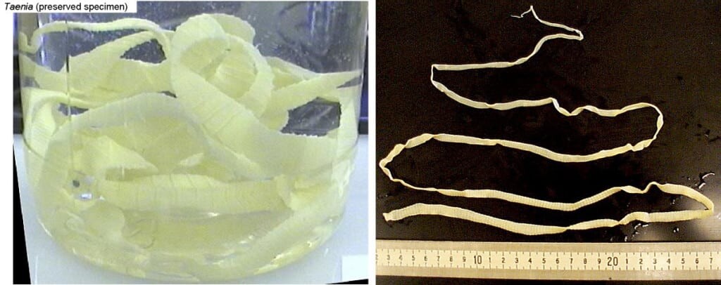 Ver solitaire - Ténia : Êtes-vous concerné